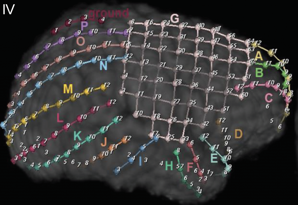Computer Architecture for Brain-Computer Interfaces | SIGARCH